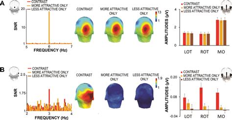 Spectral Representation And Scalp Distribution Of Eeg Signal During