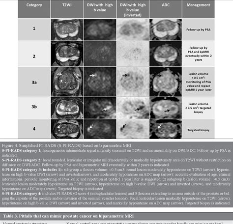 Figure 4 From Biparametric Mri Of The Prostate Semantic Scholar