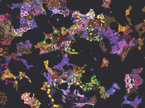 Visual Proteomics Observing Protein Location In Living Cells