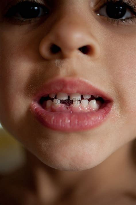 Girl With Missing Teeth Picture And Hd Photos Free Download On Lovepik