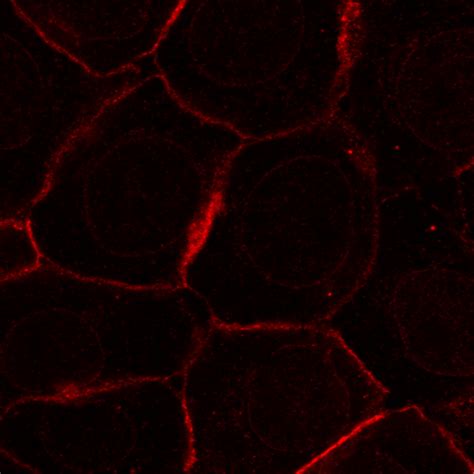 How To Perfom Psf Generation And Image Deconvolution Using Deconvolutionlab2 Researchgate