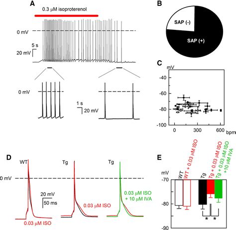 Figure 1 From Ectopic Automaticity Induced In Ventricular Myocytes By