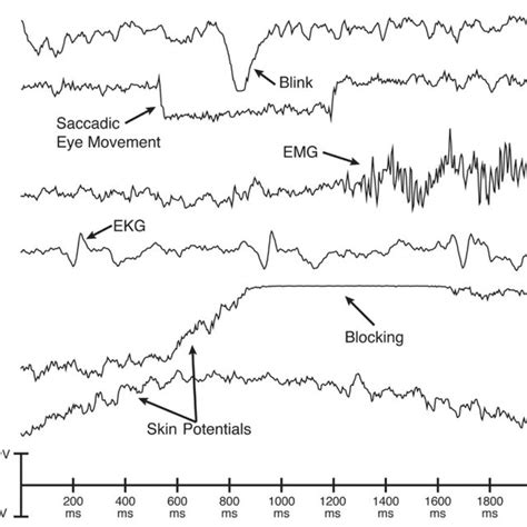 Examples Of Single Trial Waveforms Showing Common Artifacts Each