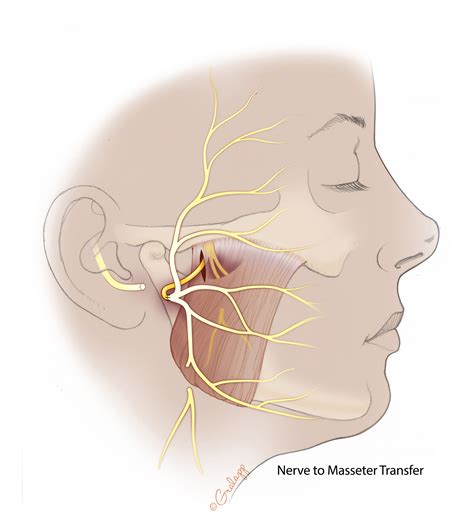 Hypoglossal Trigeminal Facial Anastomoses Oto Surgery Atlas