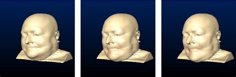 figure 3 from finite element simulation of soft tissue deformation