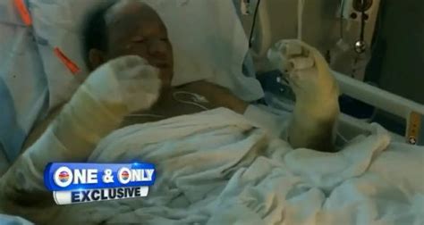 Celebrity Chef Ralph Pagano Was Severely Burned In An Explosion At His