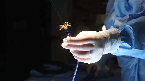 Ascension Bay Offers Pulsed Field Ablation Treatment For Afib Patients