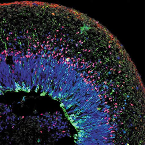 How Brain Organoids Are Revolutionizing Neuroscience Ieee Pulse