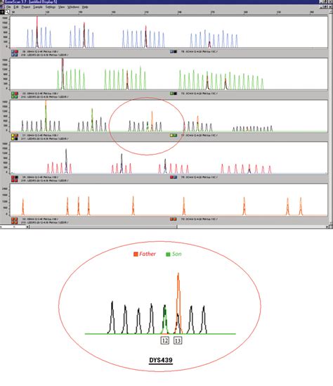 Electropherogram Of Mutation Between An Alleged Father And His Son In Download Scientific