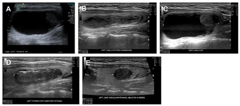 Gw Medicines Center For Minimally Invasive Treatments For Thyroid