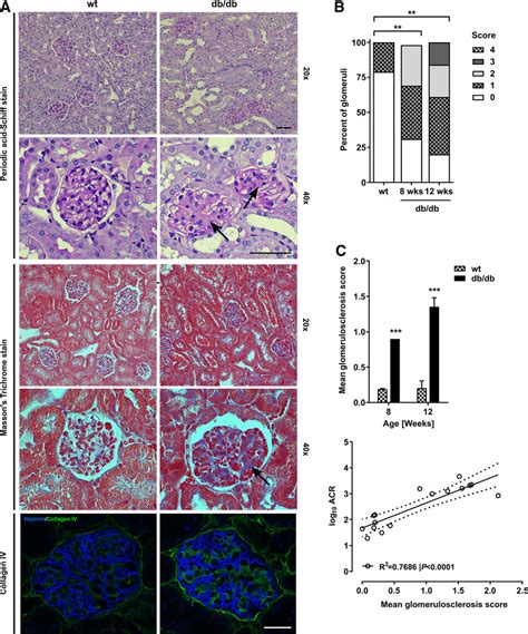 Renal Histopathology In The Db Db Dba 2j Mouse A Representative