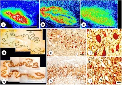 Fe Cu And Zn Xrf Maps Of A Normal Dn And Matching Sections After Download Scientific Diagram