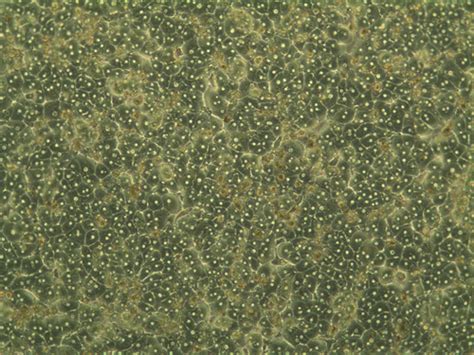 Hepatic Cells Human Hepatocytes And Non Human Hepatic Cells