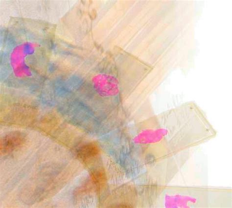 Custom Tissue Sections And Microarrays
