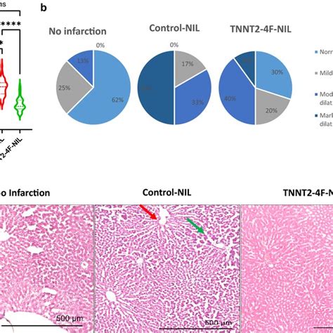 Histopathological Assessment Of Liver Congestion In A Rat Model Of Mi