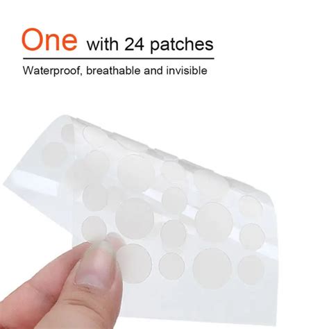 24 патча 40 шт набор инструментов для удаления акне лечение черных точек крем для удаления
