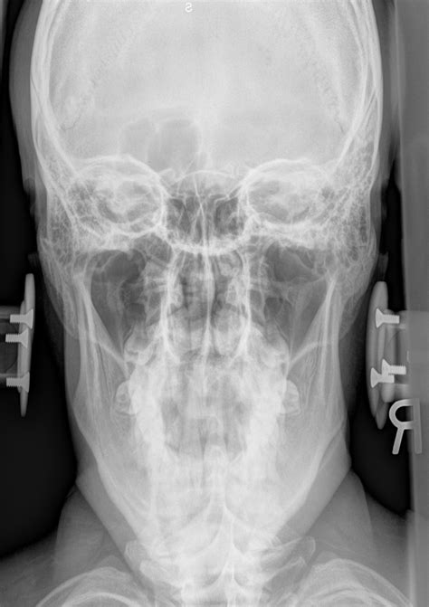 Nasium Pt 1 Diagram Quizlet
