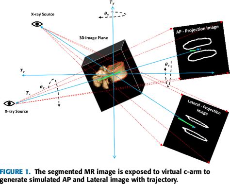 Figure 1 From Feature Based Registration Framework For Pedicle Screw Trajectory Registration