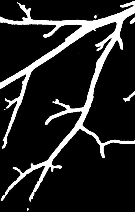 Simpleitk Readimage Cant Load Images With Inverted Luts · Issue 13 · Jacobbumgarnervesselvio