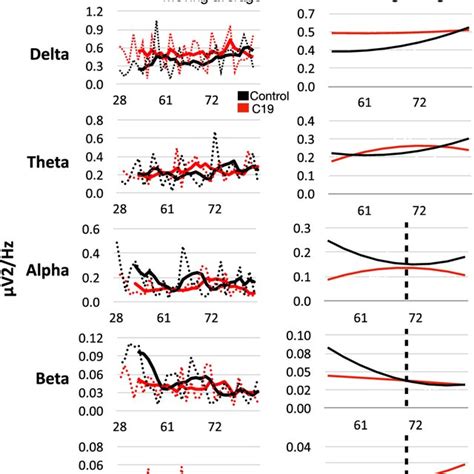 A Power Spectral Density Mean Of 16 EEG Channels In Age Below 70 Download Scientific