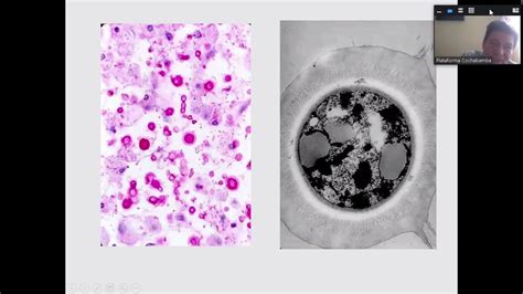 Parasitología Criptococosis Youtube