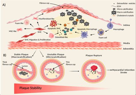 Coronary Artery Disease Treatment And Management Point Of Care