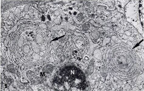 detail of a plasma cell illustrating concentric arrays of rough er