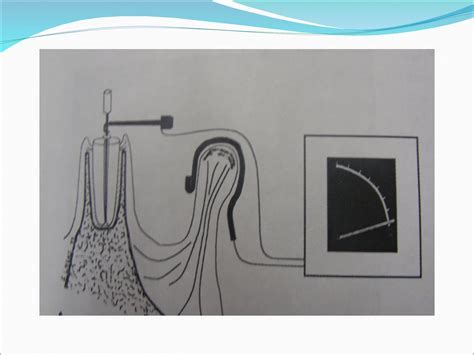 Working Length Determination And Apex Locator Ppt