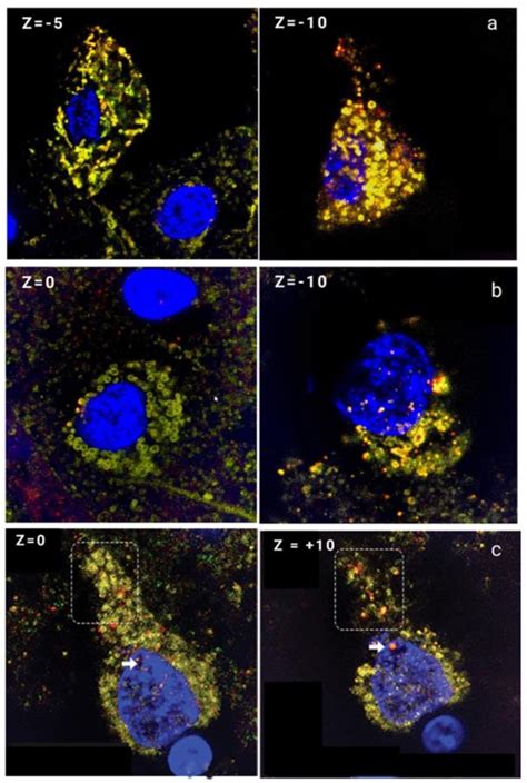 Complete Z Stack Imaging Reveals Mitochondria Clustered At The Far Download Scientific Diagram