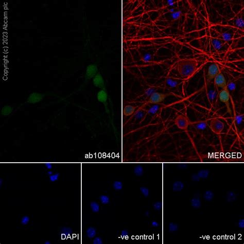Anti Calbindin Antibody [ep3478] Ab108404 Abcam