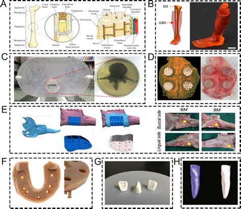 Application Of Dlp Printed Structures In The Defect Of The Orthopedics