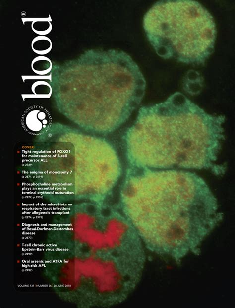 The Enigma Of Monosomy 7 Blood American Society Of Hematology