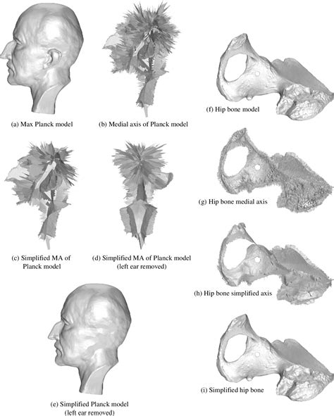 Figure 1 From Shape Simplification Based On The Medial Axis Transform