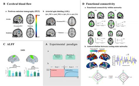 The Typical Neuroimaging Findings Associated With Midazolam Induced