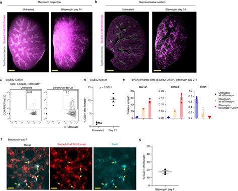 alveolar fibroblast lineage orchestrates lung inflammation and fibrosis