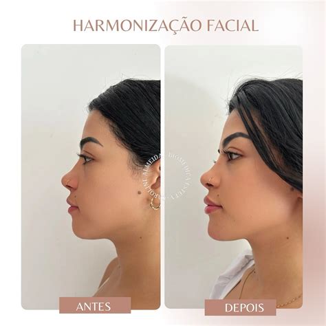 Caroline Almeida Biomédica Dracarolinealmeidaa • Instagram Photos