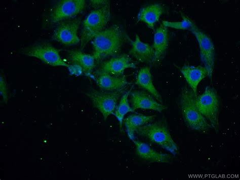 Results For Alpha Synuclein Proteintech Group