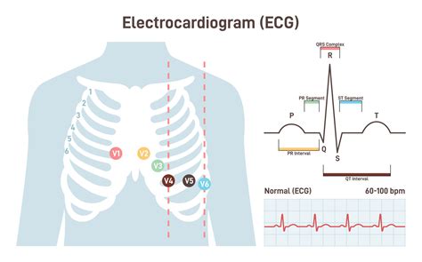 Ecg Procedure Cardiovascular Checkup With Cardiogram Heart Disease 46422656 Vector Art At Vecteezy