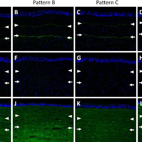 Expression Of Fibronectin A To D Cd11b E To H And Collagen