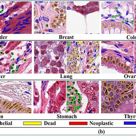 Transformer Based Architectures For Histopathological Image Analysis Download Scientific