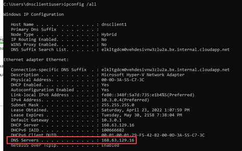 Default Dns Azure Vm