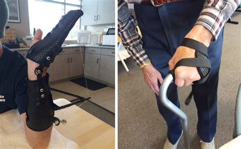 Benefits Of Custom Made Splints For Hand And Wrist Injuries Ptandme