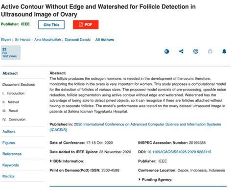 [publikasi] Active Contour Without Edge And Watershed For Follicle Detection In Ultrasound Image