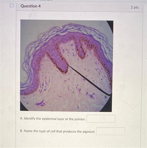 Question 1 A Identify The Layer Of Skin At A B