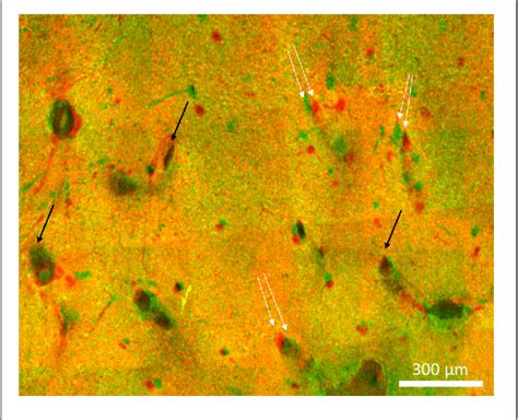 Figure 10 From 3d Reconstruction Of The Intracortical Volume Around A Hybrid Microelectrode