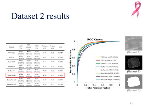 Computer‐aided Diagnosis Of Breast Cancer Using Ensemble Convolutional