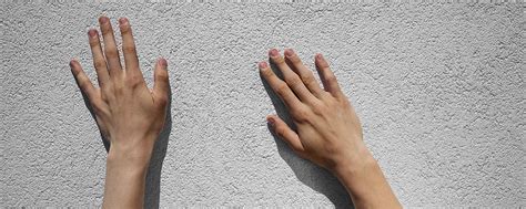 Scleroderma Hand Surgery