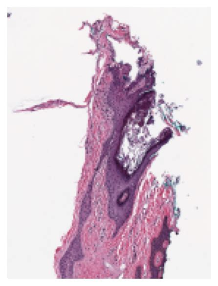 Stain Normalization TIA Toolbox Documentation