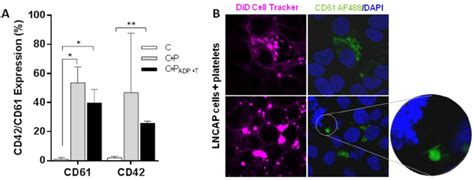 Transference Of Platelet Proteins To Tumor Cells A Cd61 And Cd42