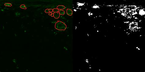 how to count dense core amyloid plaques using imagej or matlab